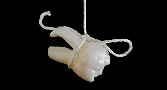 Extractie dentara - ABC Eurodent, clinica familiei tale