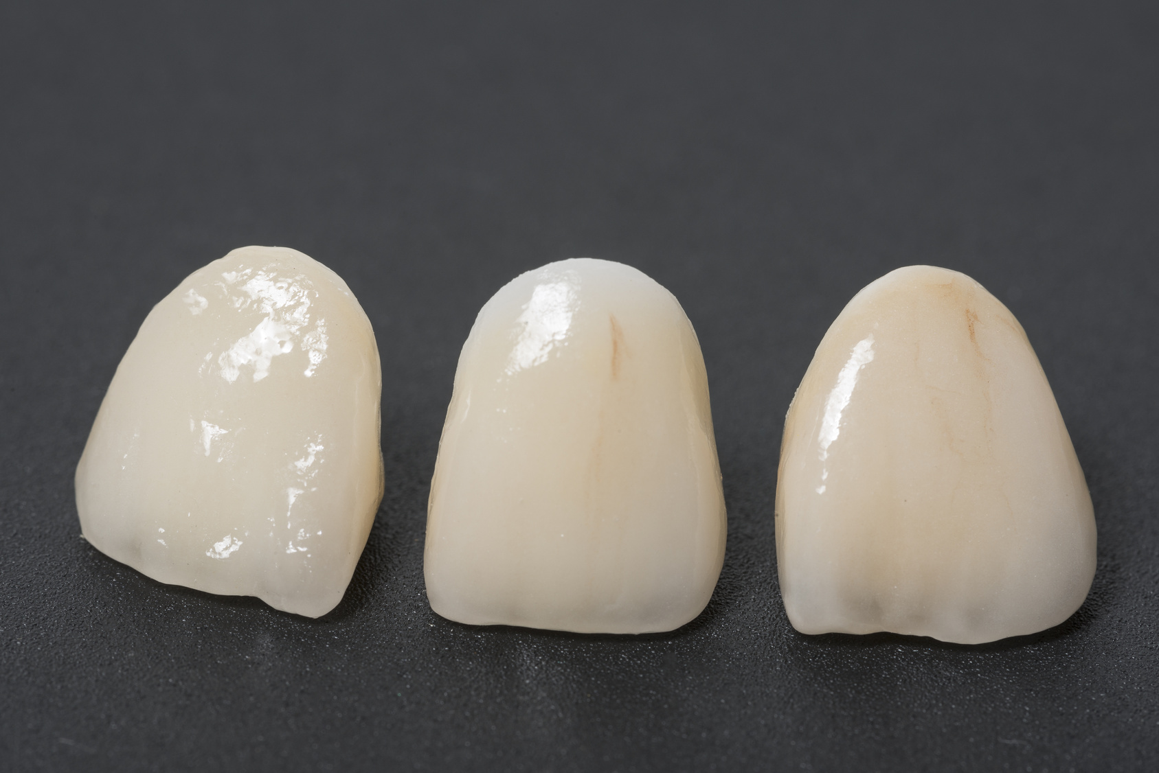 Fateta dentara - ABC Eurodent, clinica familiei tale