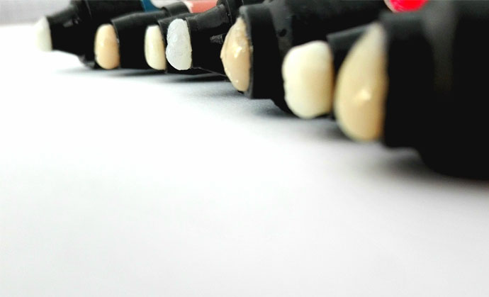 Compozite dentare - ABC Eurodent, clinica familiei tale