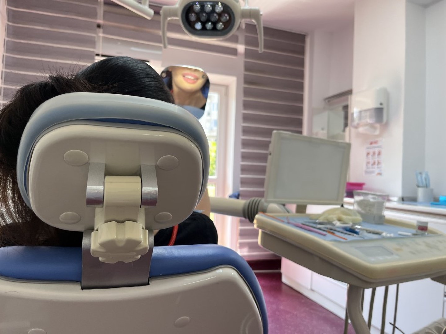 Fatete dentare din compozit: zambet perfect, in doar 4 ore